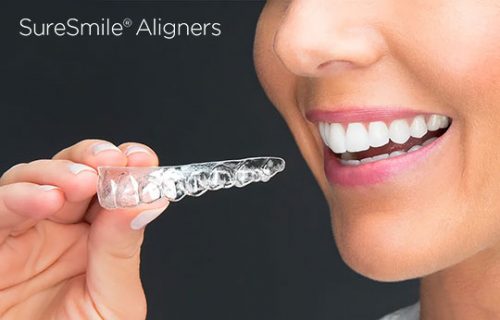 Maintain Your Perfect Smile with an Orthodontic Retainer in Fort ...